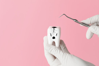 Broken Tooth Repair Cost | Emergency Dentist Adelaide