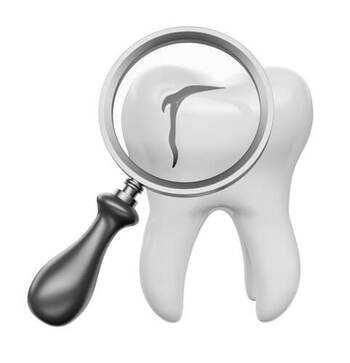 Tooth Cracked in Half | Emergency Dentist Adelaide Dr