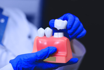 Bite Test for Cracked Tooth | Emergency Dentist Adelaide